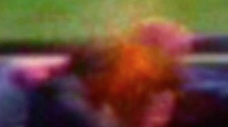 JFK’s Occipital Head Wound Still A Myth – Hollywood Elsewhere